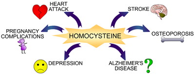 High Homocysteine | Health Boundaries